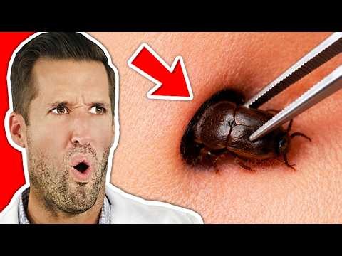 It Crawled WHERE?!