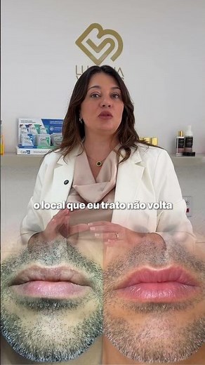 Did you have Fordyce treatment and it came back? There’s an explanation | Dr. Luciana Villas Bôas