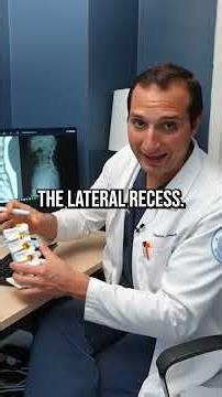 Bone on Bone Facet Arthritis on CT and MRI