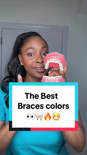 Best Braces Colors That Make Teeth Look Whiter