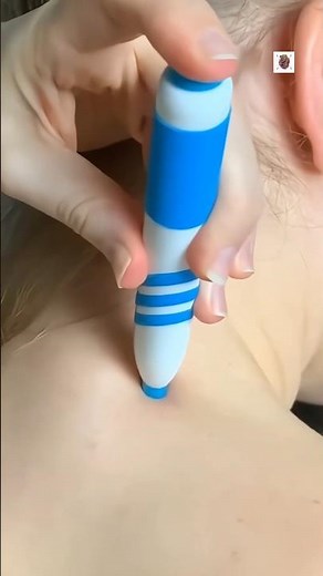 Remove Skin Tags at Home in 1 Minute with This Simple Tool 😱