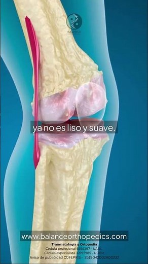 El Sonido de Alarma: ¿Qué significa el 'crujido' que sientes en tu cuerpo? 🦴