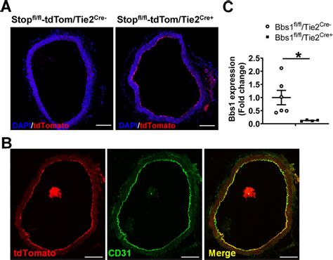 Validation Of Endothelial Specific Bbs1 Gene Knockout Mice A