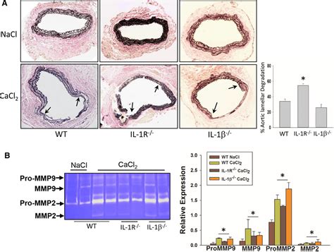 Il 1β Interleukin 1β And Tnf α Tumor Necrosis Factor α Impact