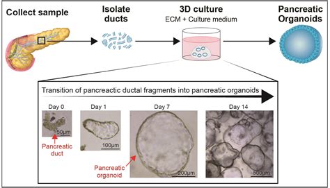Human Pancreas Organoids A Step Closer To Understanding Biology