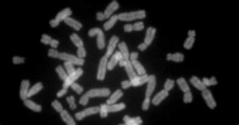 Men Are Slowly Losing Their Y Chromosome A New Sex Gene Discovery In