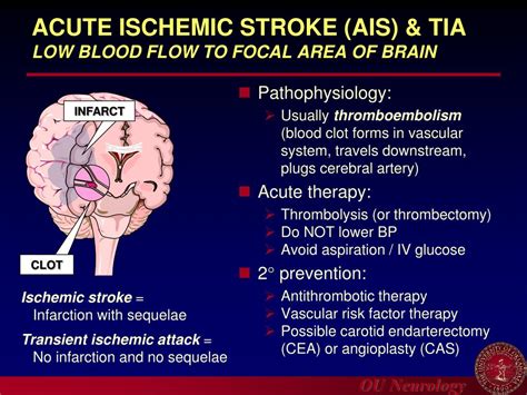Ppt Update In Acute Ischemic Stroke Management Powerpoint