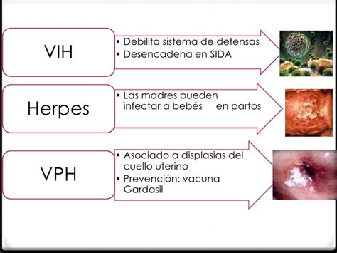 Enfermedades De Transmisión Sexual