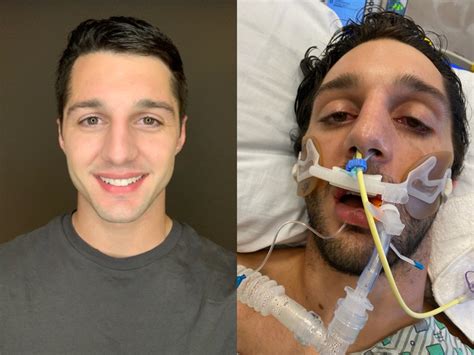 Guillain Barré Syndrome Survivor 26 Misdiagnosed With Herniated Disk