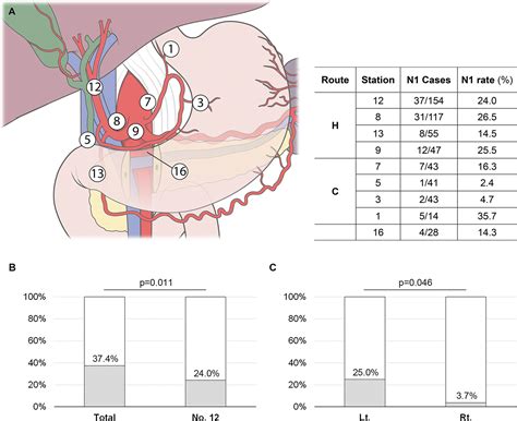 Extent Of Lymph Node Dissection For Accurate Staging In Intrahepatic