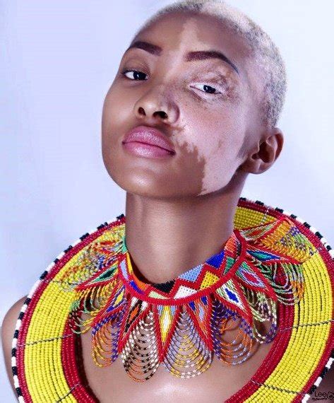 Meet 8 Women On Instagram Proudly Flaunting Their Unique Birthmarks