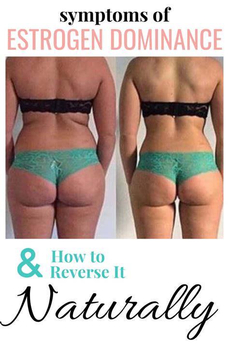 How To Reverse Estrogen Dominance Quickly Naturally Artofit