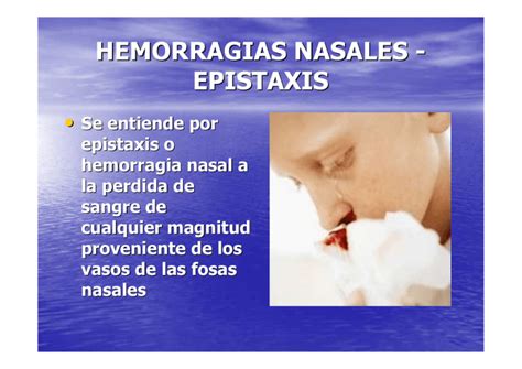 Hemorragias Nasales