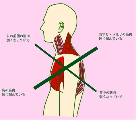 デスクワーカーの首肩の痛み 中央区日本橋 Edo鍼灸治療院