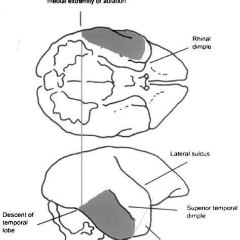 Reconstructions Of The Inferotemporal Ablation And Ca1 Subiculum Lesion