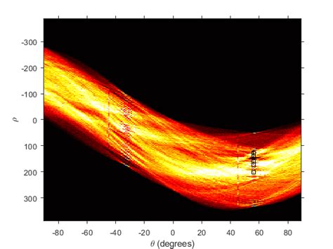 hough transform matlab and simulink mathworks united kingdom