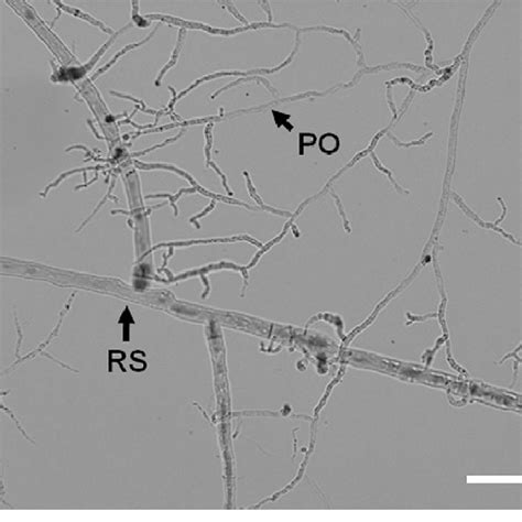Effect Of Potato Seed Tuber Treatment With Pythium Oligandrum Or