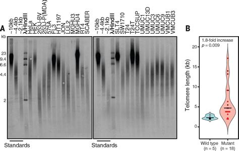 Tert Promoter Mutations And Telomerase Reactivation In Urothelial
