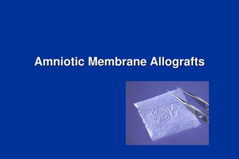 Ppt Processed Amniotic Membrane Allografts Powerpoint Presentation