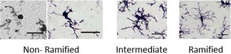 Sex Differences In Microglia Activity Within The Periaqueductal Gray Of