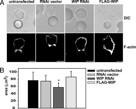 Wip Is Essential For Lytic Granule Polarization And Nk Cell