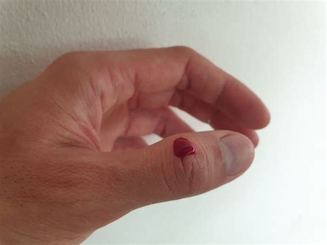This Gel Stops Bleeding In Only 10 Seconds Step To Health