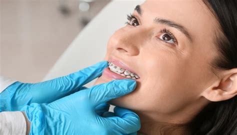 Understanding How To Fix An Overbite Options And Outcomes Grove