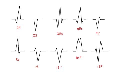 Ecg Of The Week Ecg Reference Notes