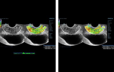 Ultrasound Journal 8 An Example Of The Use Of Multiparametric