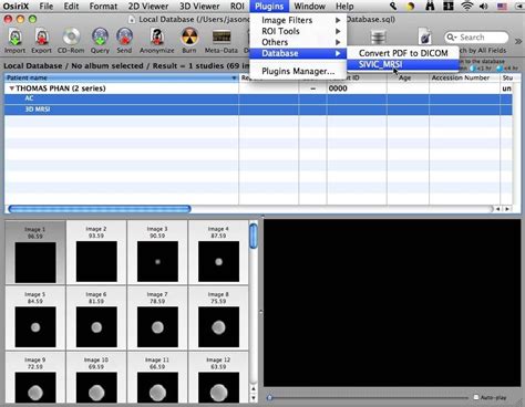 sivic open source dicom mr spectroscopy framework for