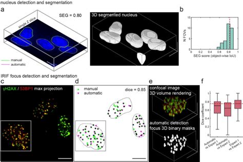 the results of nucleus segmentation and irif detection a b the nucleus