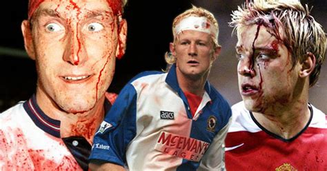 wayne rooney s gash and 40 more pictures of footballers covered in