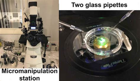 Assisted Reproduction Frontiers In Outer Space Innovaspace
