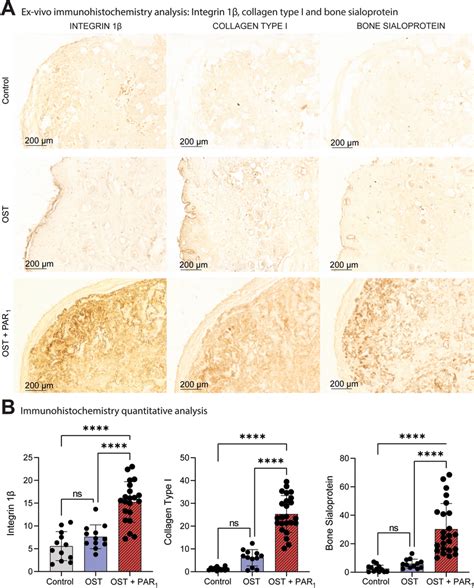 A Histological Immunohistochemistry Quantification Analysis For