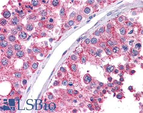 Ihc Plus™ Wt1 Wilms Tumor 1 Polyclonal Antibody Rabbit Ihc Wb Lsbio