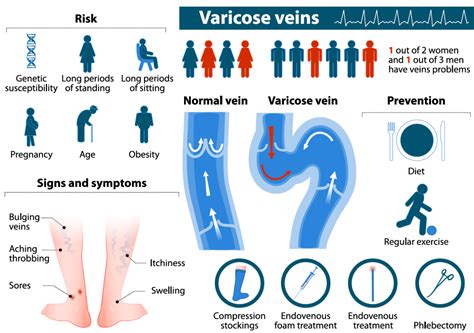 Varicose Veins Disorders And Procedures Vein Specialists Of The Carolinas