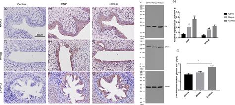 C Type Natriuretic Peptide Regulates Sperm Capacitation By The Cgmp Pkg