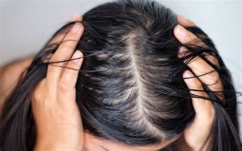 Oily Scalp With Dry Ends Why And How To Control Skinkraft