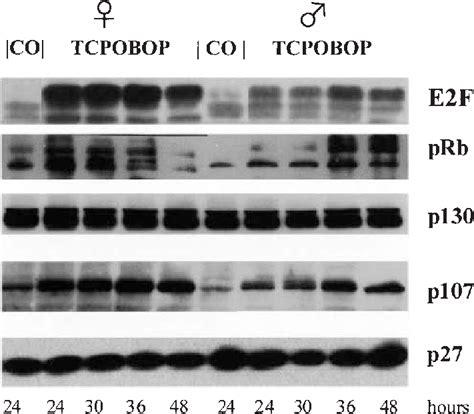 Western Blot Analysis Of E2f Prb P130 P107 And P27 In Female And Male