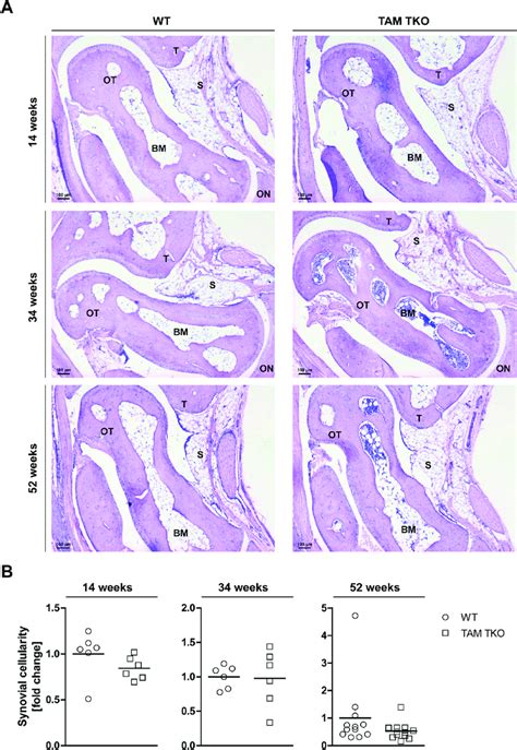 Effect Of Genetic Deletion Of Tyro3 Axl Mertk On Synovial Cellularity
