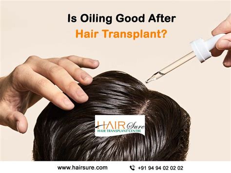 Is Oiling Good After Hair Transplant Hair Sure