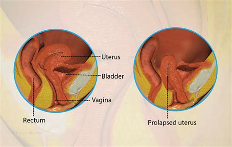 Health Condition Symptoms Causes Treatment And More