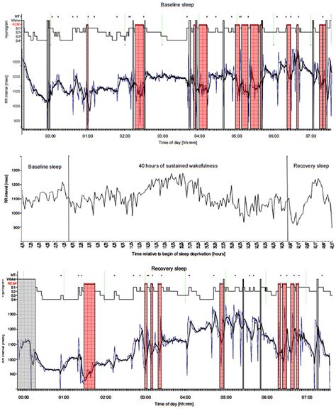 Example Of Variation Of Heart Rate 15 Min Mean Due To Sleep Stage