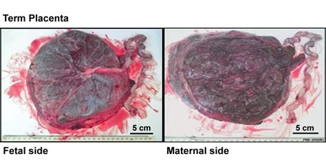 Lecture Placenta Development Embryology