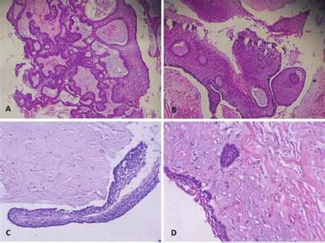 Histopathological Findings Hematoxylin And Eosin Staining X200