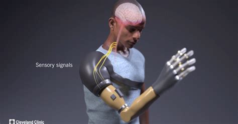 Futuristic Bionic Arm Helps Amputees Feel The Sensation Of Touch And