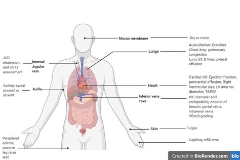 Integrative Volume Status Assessment Pocus Journal