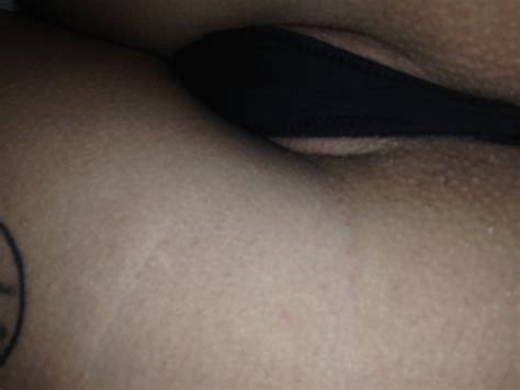 Skin Close Up Arm Joint Porn Pic Eporner
