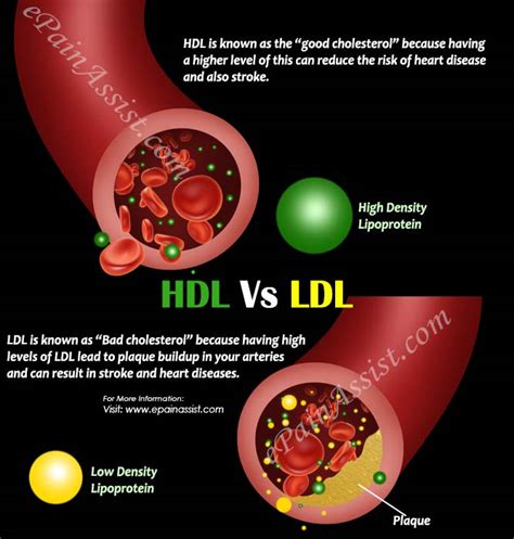 Ldl And Hdl Difference