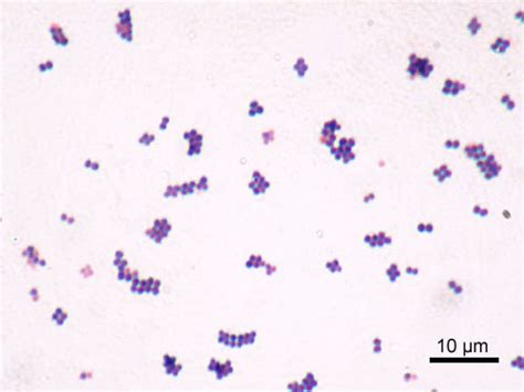 Introduction To Staphylococcus Microbiology Medbullets Step 1